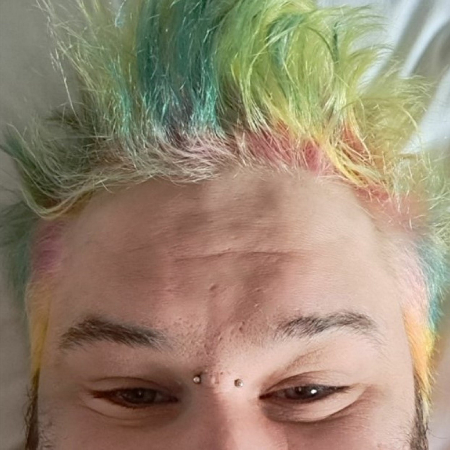 Brunox Turbo · Artist Profile